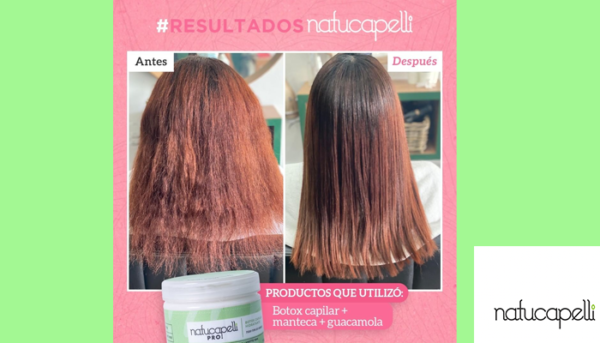 Tratamiento De Botox Para el Pelo – Guía completa
